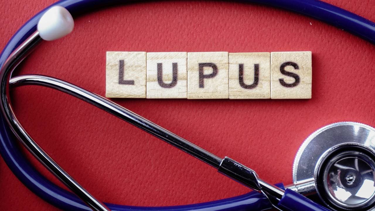 Boala Lupus. Tot ce trebuie sa stii despre lupusul eritematos sistemic ...